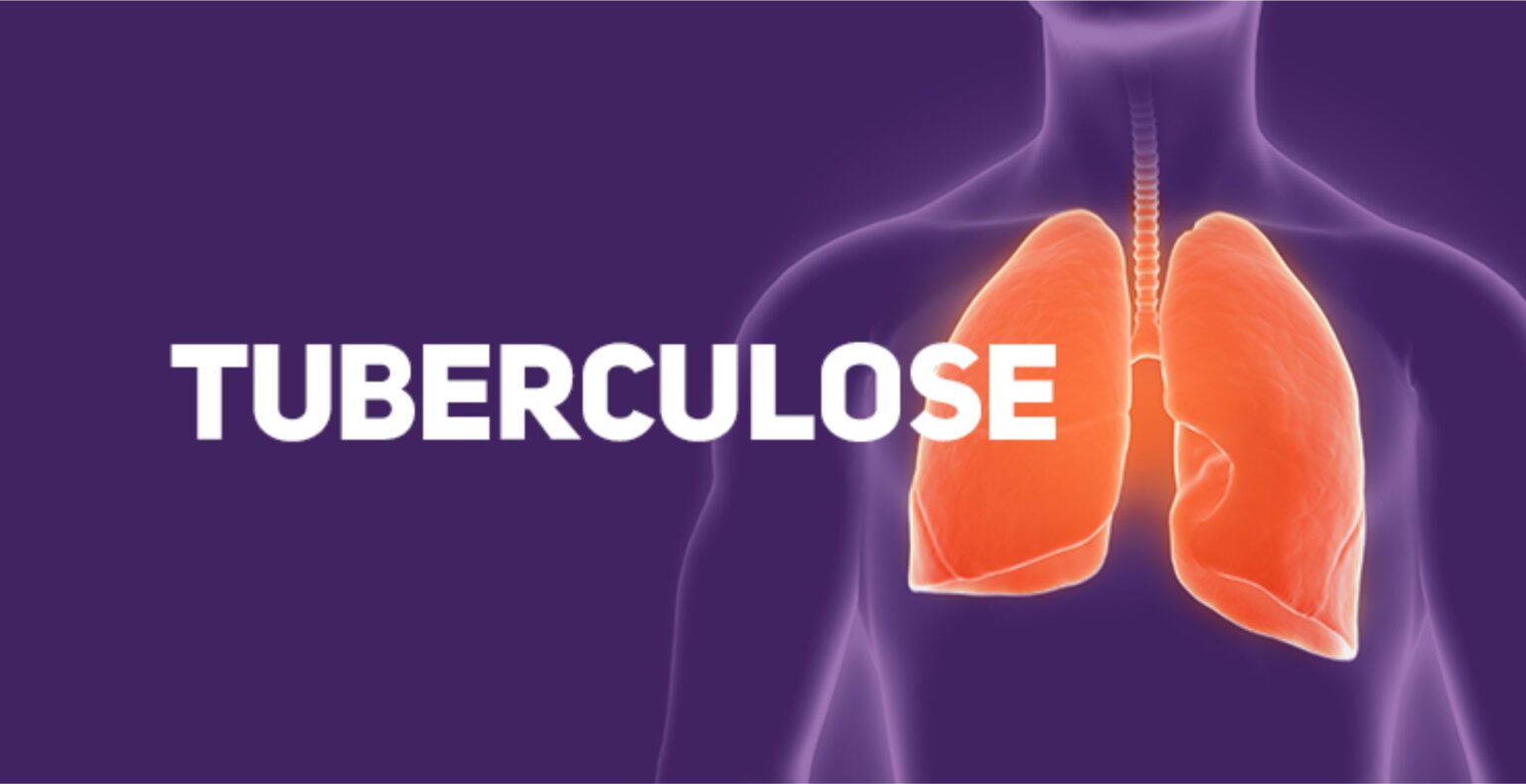 TUBERCULOSE – Defensores do Planeta